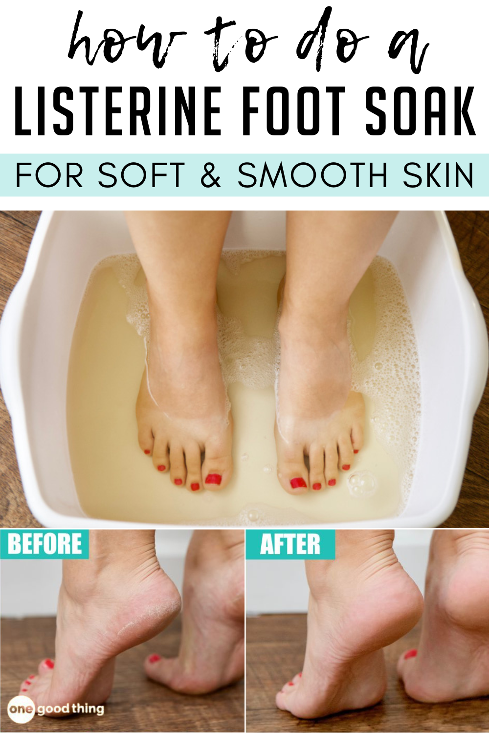 Listerine Foot Soak: Why It Works & How To Do It